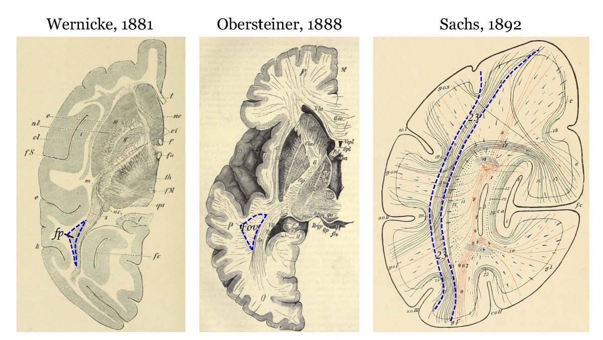Reading and the Brain: Rediscovery of a Major Pathway | I-LABS